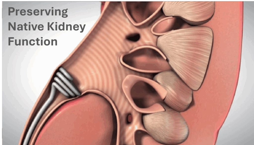 Preserving Native Kidney Function: The Ultimate Goal in Kidney Care ...